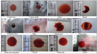 Blood pattern analysis | PPTX