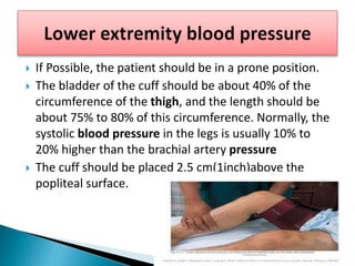 Blood pressure | PPTX