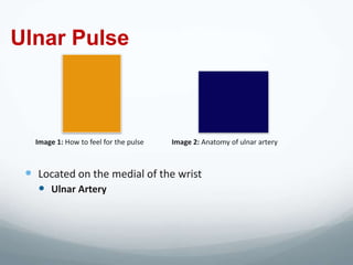 Ulnar Pulse