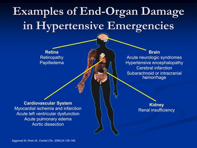 Blood Pressure Control in Neuro ICU | PPT