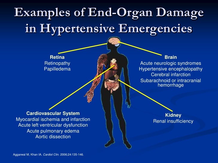 Blood Pressure Control in Neuro ICU