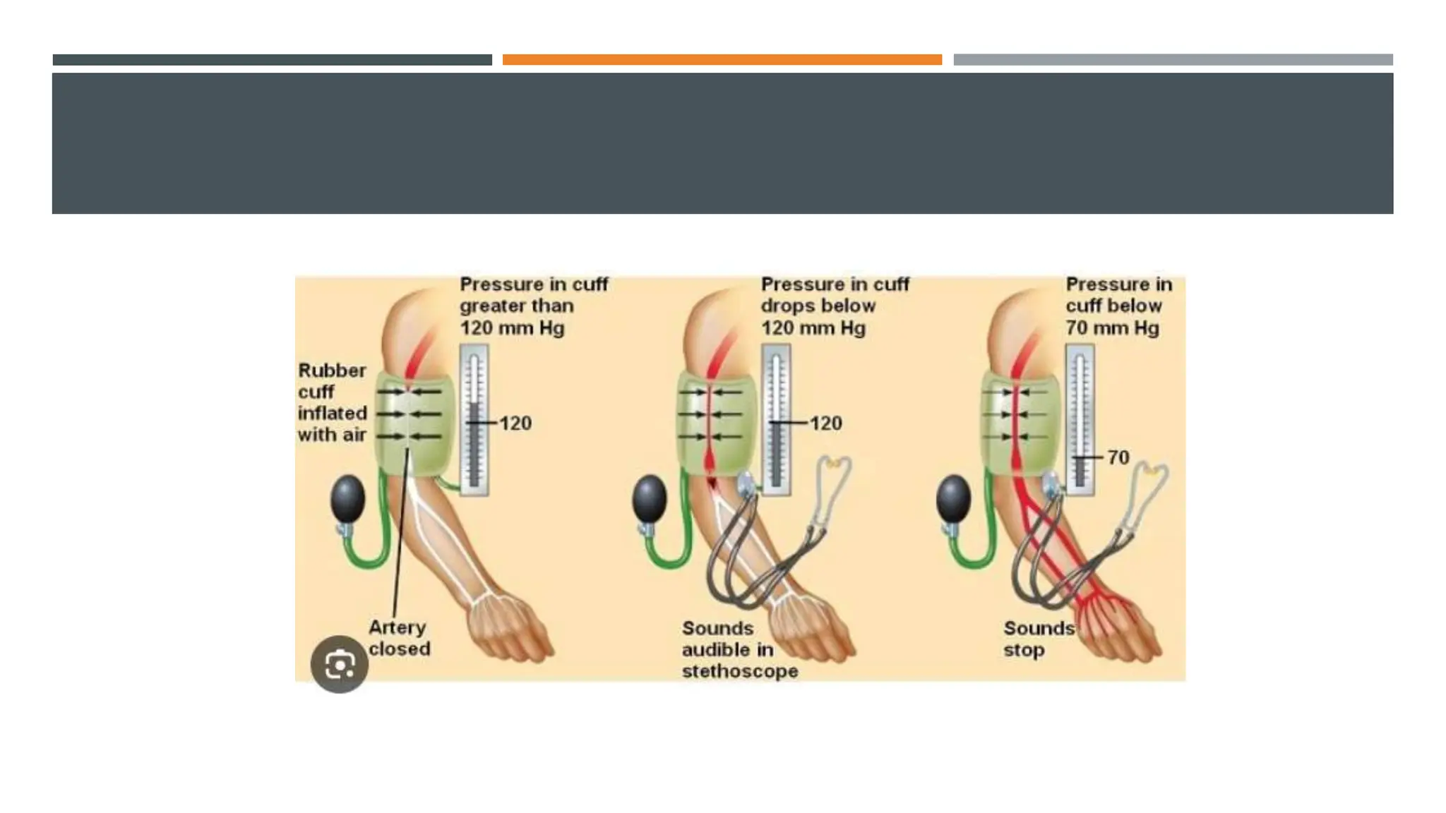 Types of Blood Pressure Measurement Techniques | PPTX