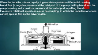 Blood pump perfusion | PPTX
