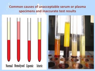 Blood samples | PPTX