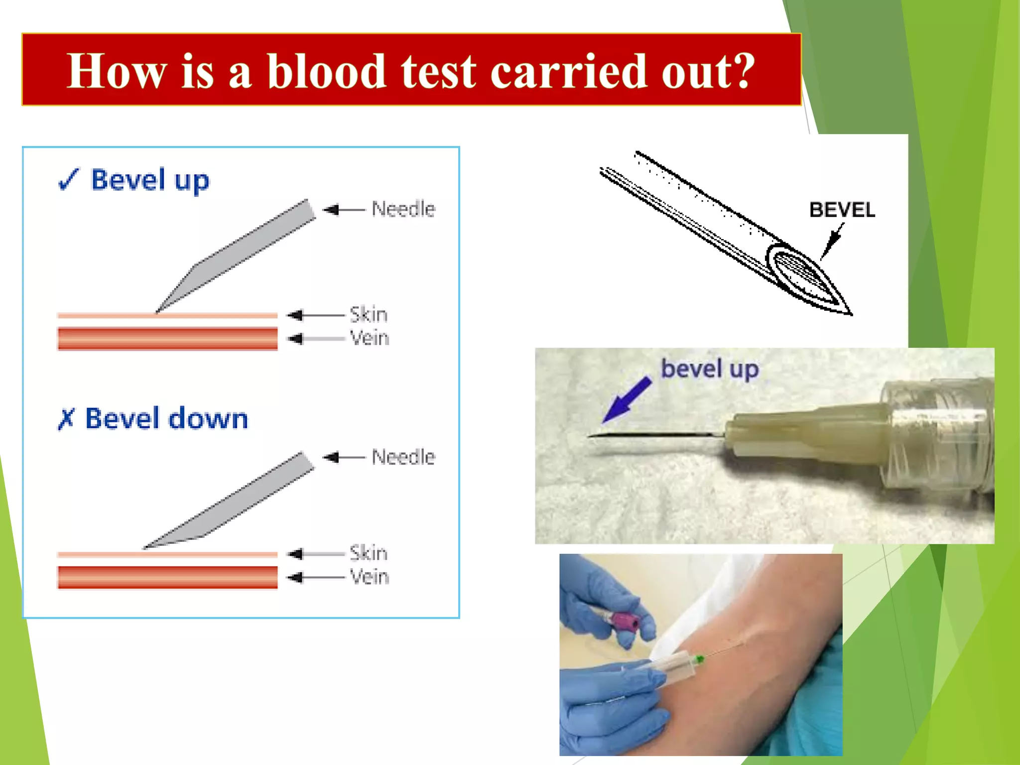 Blood Samples - equipment of blood sample | PPT