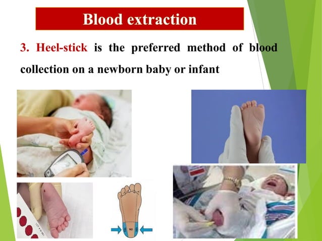 Blood Samples - equipment of blood sample | PPT