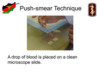 Blood smear | PPT