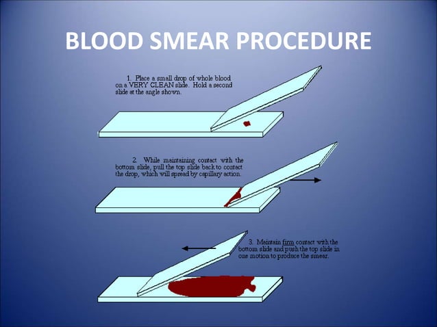 Blood smear