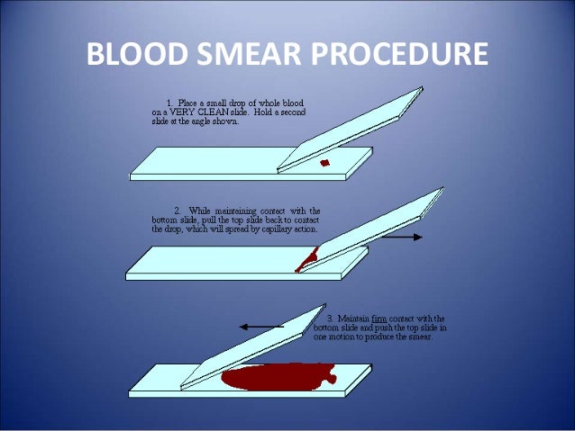 Blood smear