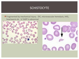 Blood smear evaluation | PPT
