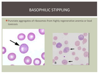 Blood smear evaluation | PPT