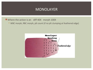Blood smear evaluation | PPT