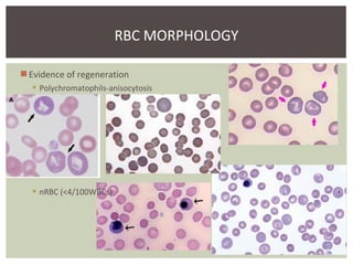 Blood smear evaluation | PPT