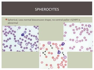 Blood smear evaluation | PPT