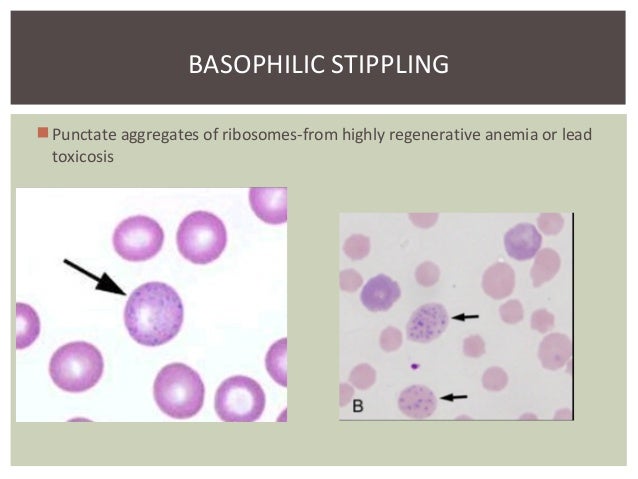 Blood smear evaluation