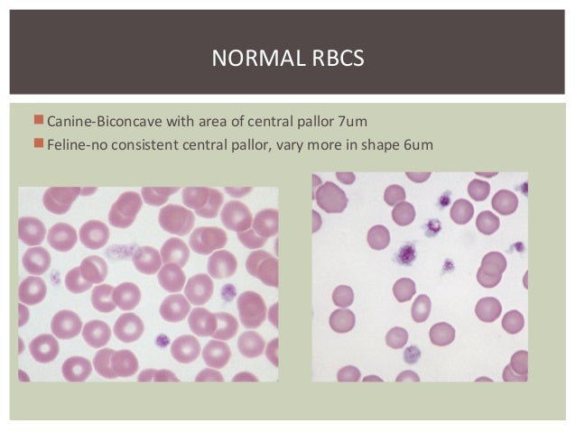 Blood smear evaluation