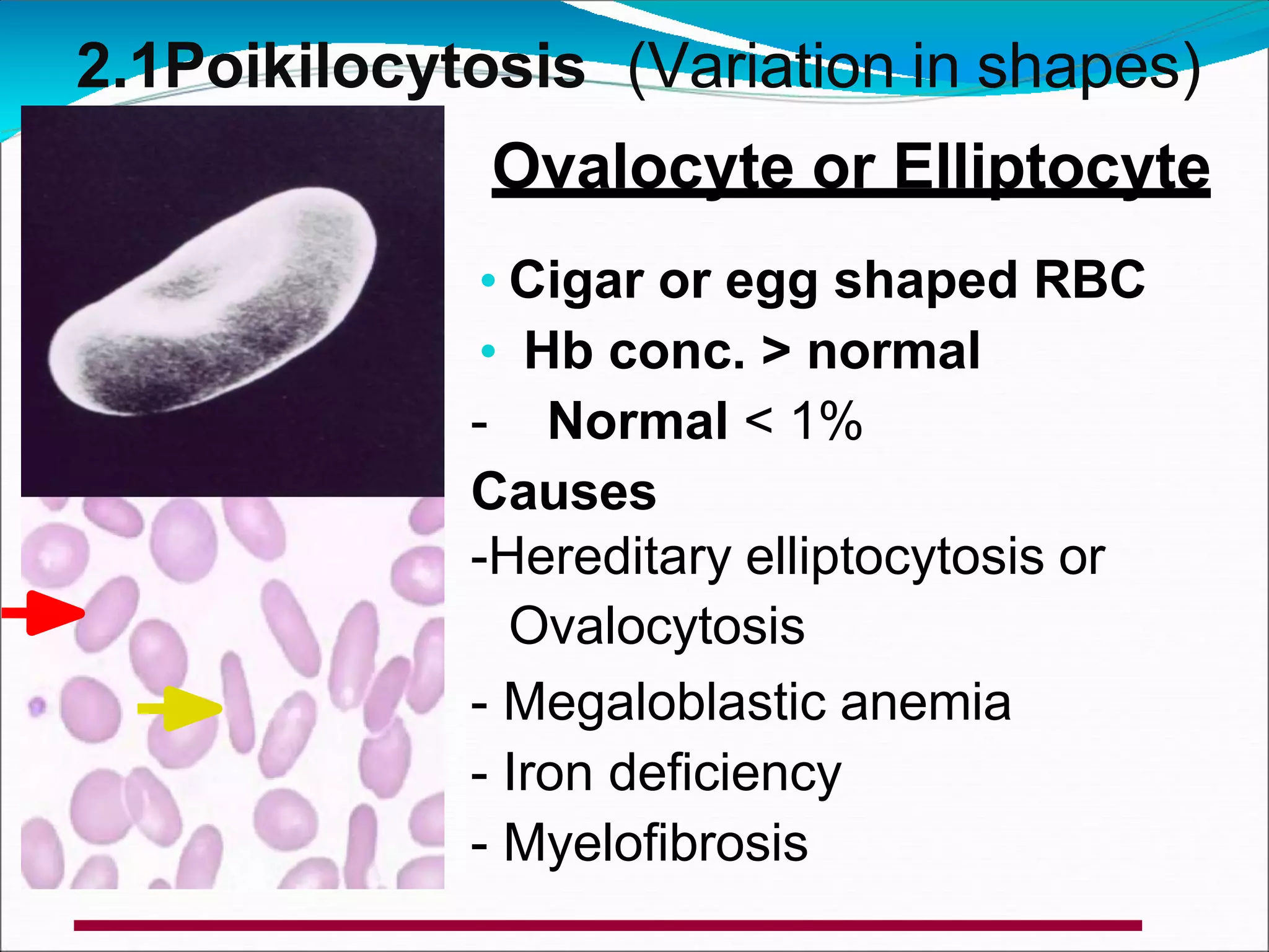 Blood smear examination 15.ppt.pptx