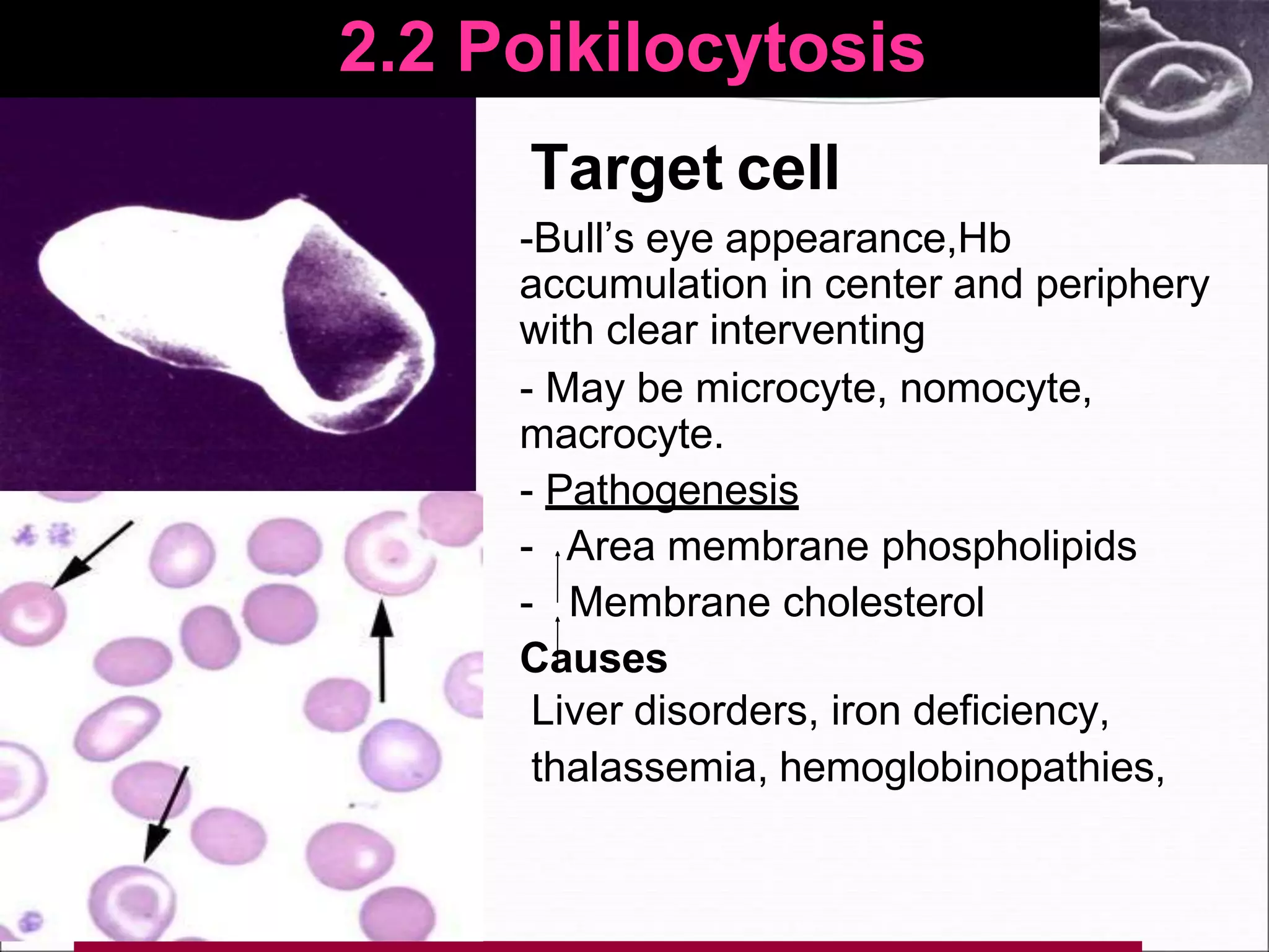 Blood smear examination 15.ppt.pptx