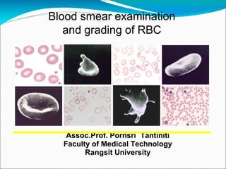 Blood smear examination 15.ppt.pptx