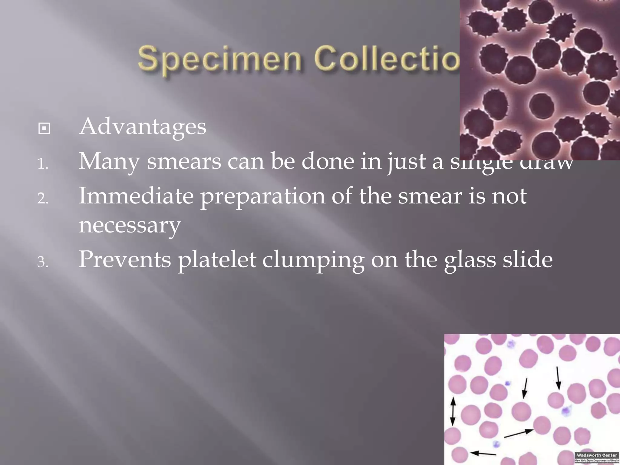 Blood smear prep | PPTX