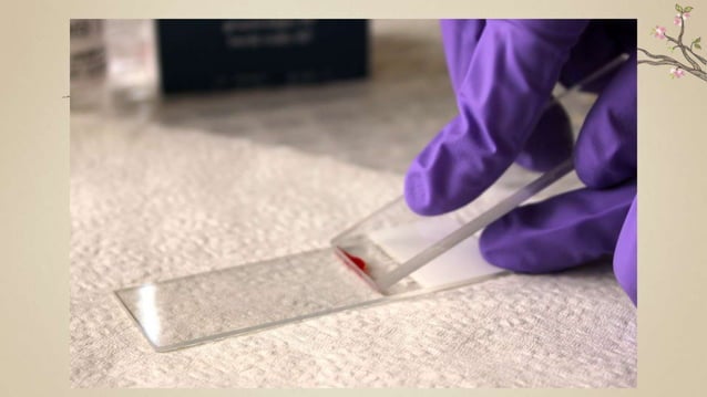 Blood Smear preparation.pptx | Blood Disorders | Diseases and Conditions