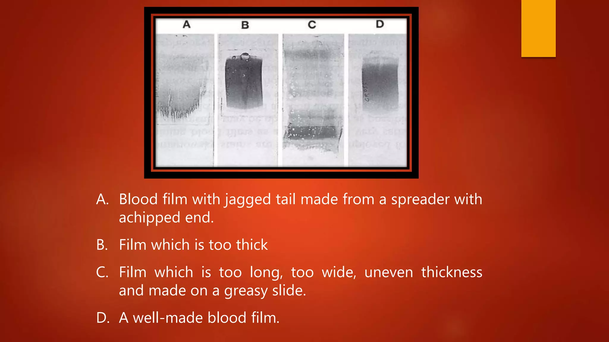 Blood smear preparation, fixation, staining. Veterinary Clinical ...