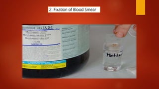 Blood smear preparation, fixation, staining. Veterinary Clinical ...