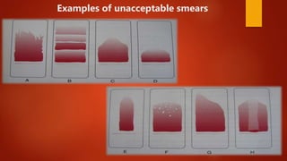 Blood smear preparation, fixation, staining. Veterinary Clinical ...