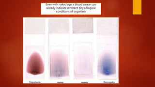 Blood smear preparation, fixation, staining. Veterinary Clinical ...