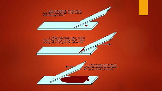 Blood smear preparation, fixation, staining. Veterinary Clinical Exam…