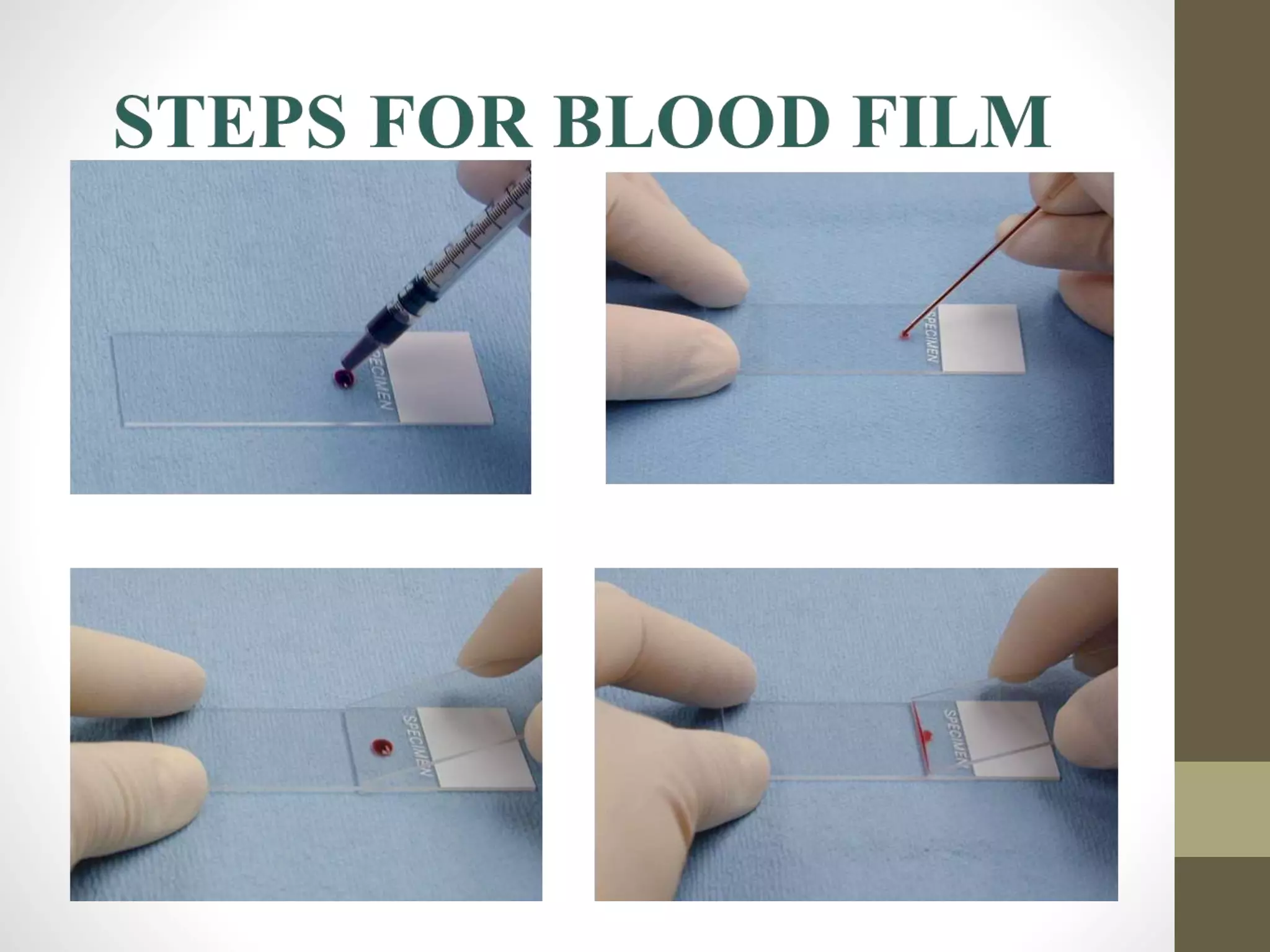 Blood smear staining | PPTX