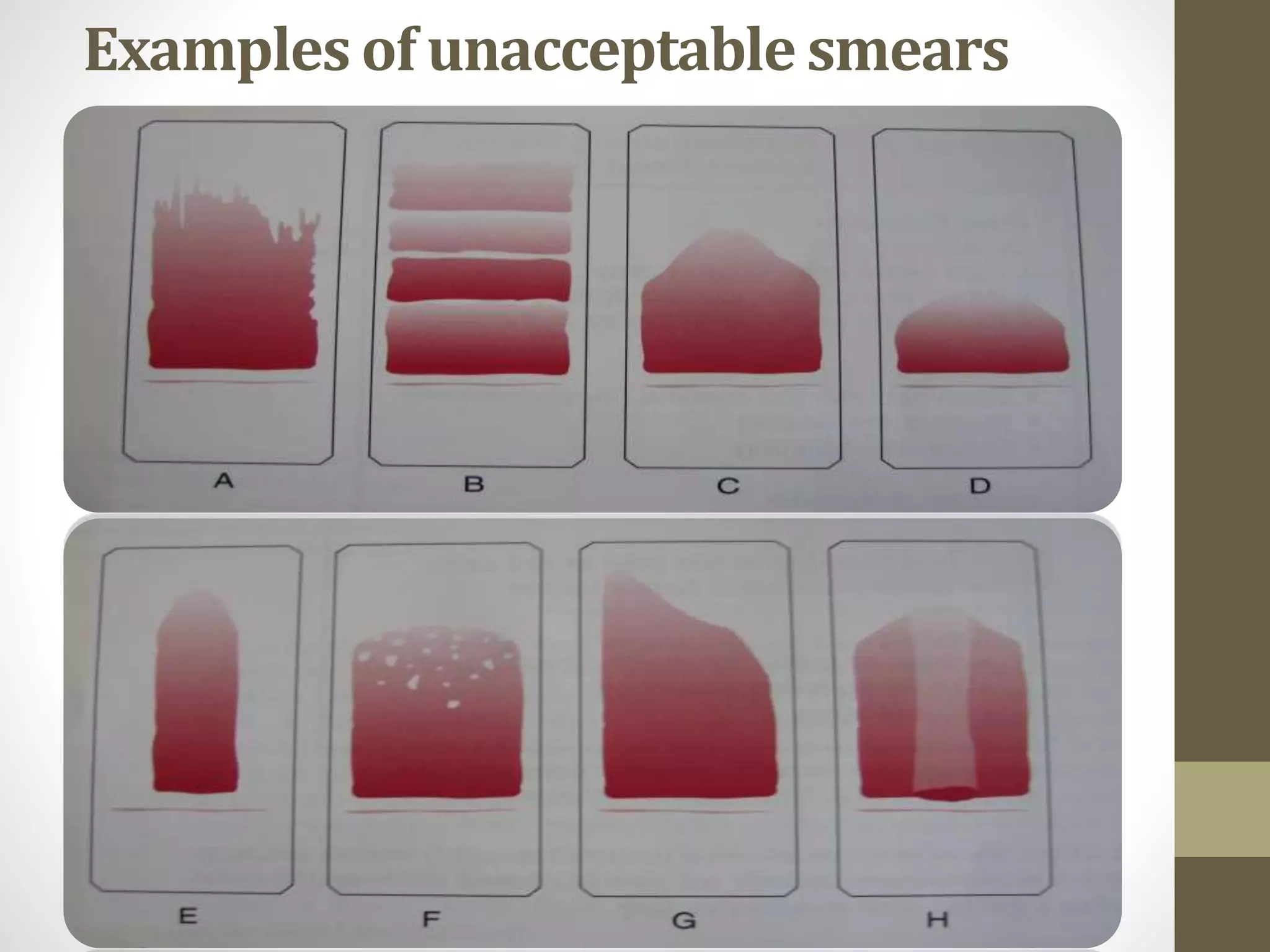 Blood smear staining | PPTX