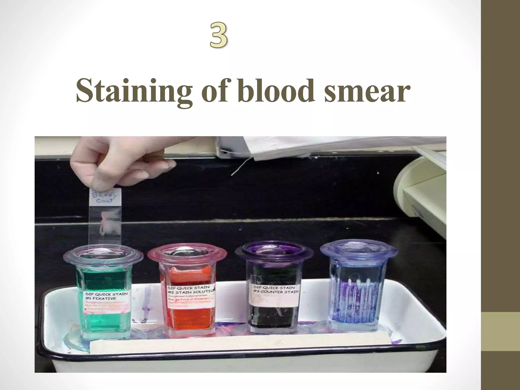 Blood smear staining | PPTX