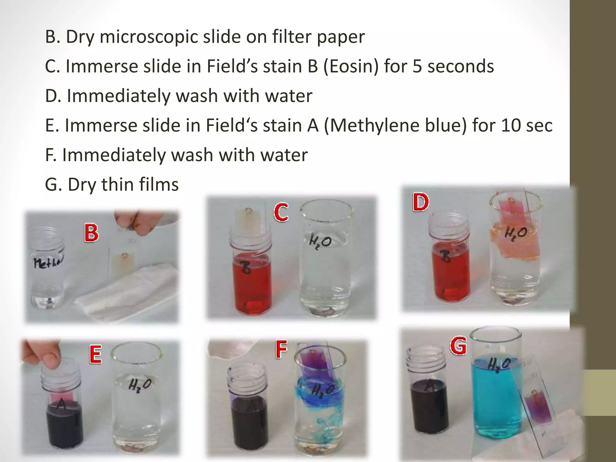 Blood smear staining | PPTX
