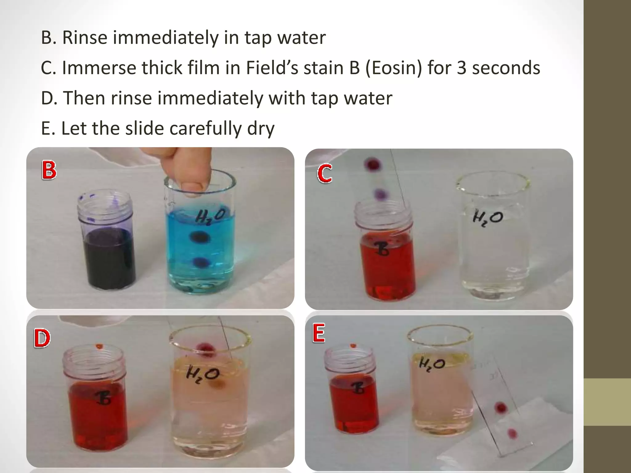 Blood smear staining | PPTX