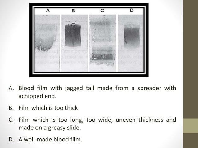 Blood smear staining | PPTX | Blood Disorders | Diseases and Conditions