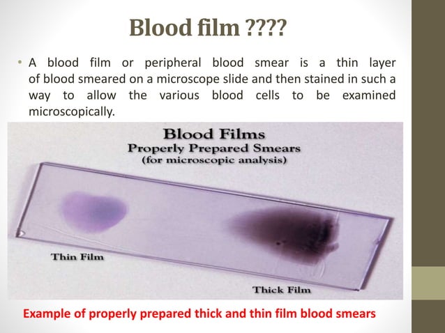 Blood smear staining | PPTX | Blood Disorders | Diseases and Conditions