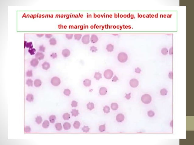 Blood smear staining | PPTX | Blood Disorders | Diseases and Conditions