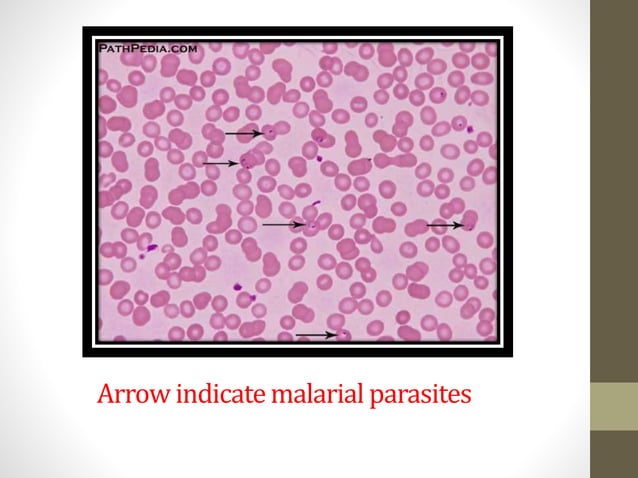 Blood smear staining | PPTX | Blood Disorders | Diseases and Conditions