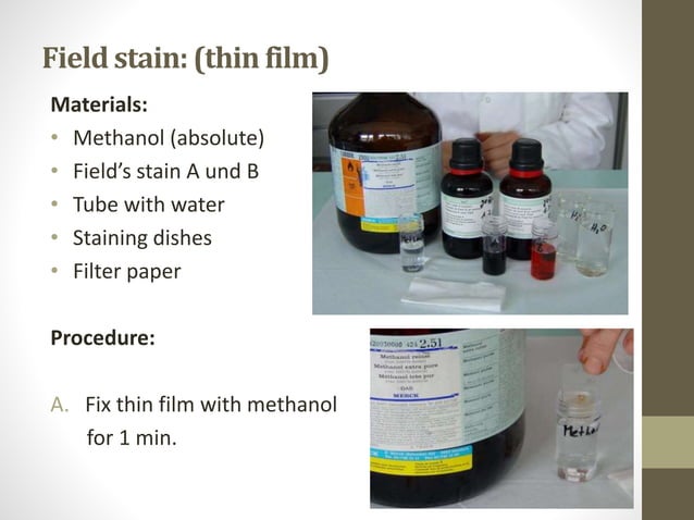 Blood smear staining | PPTX | Blood Disorders | Diseases and Conditions