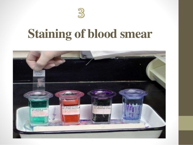 Diff Quick Blood Smear