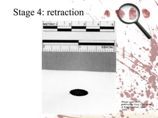 Blood spatter analysis | PPTX