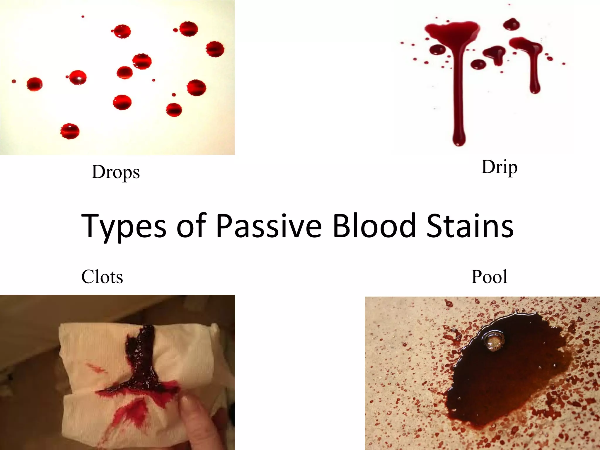 Blood Spatters Analysis | PPT