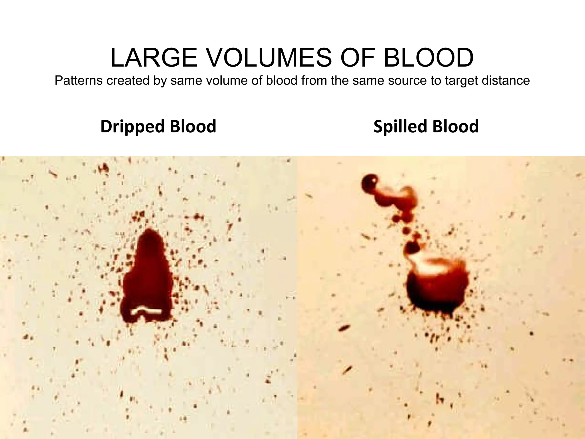 Blood Spatters Analysis | PPT