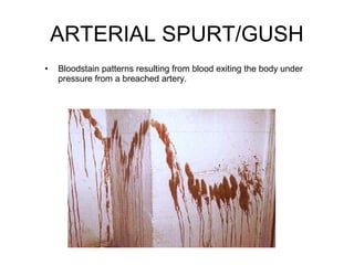 Arterial Spray Blood Spatter