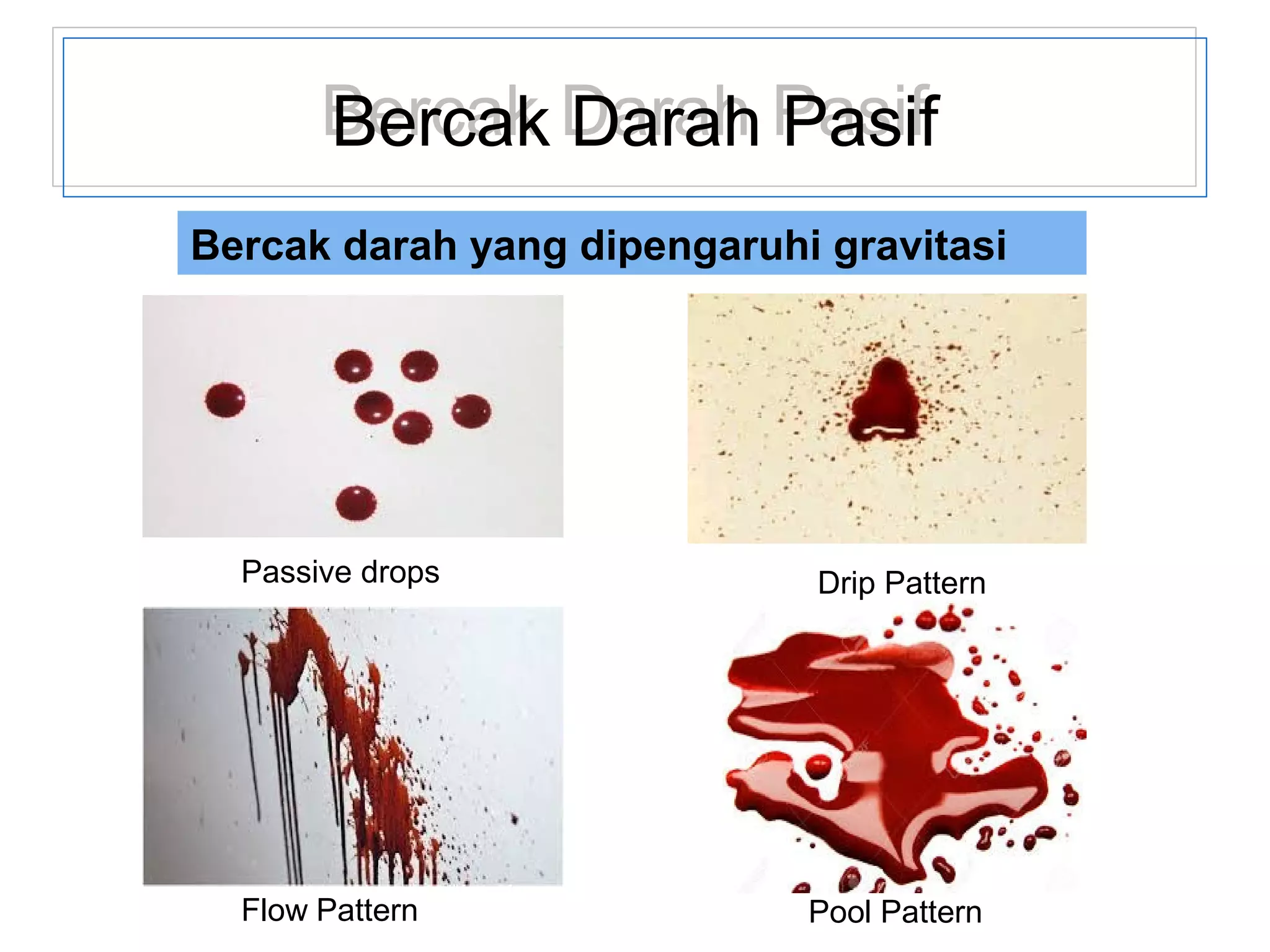 Bloodstain analysis forensik fix | PPT