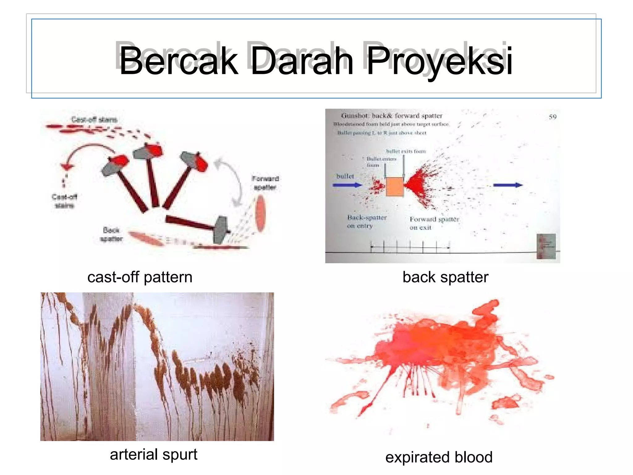Bloodstain analysis forensik fix | PPT