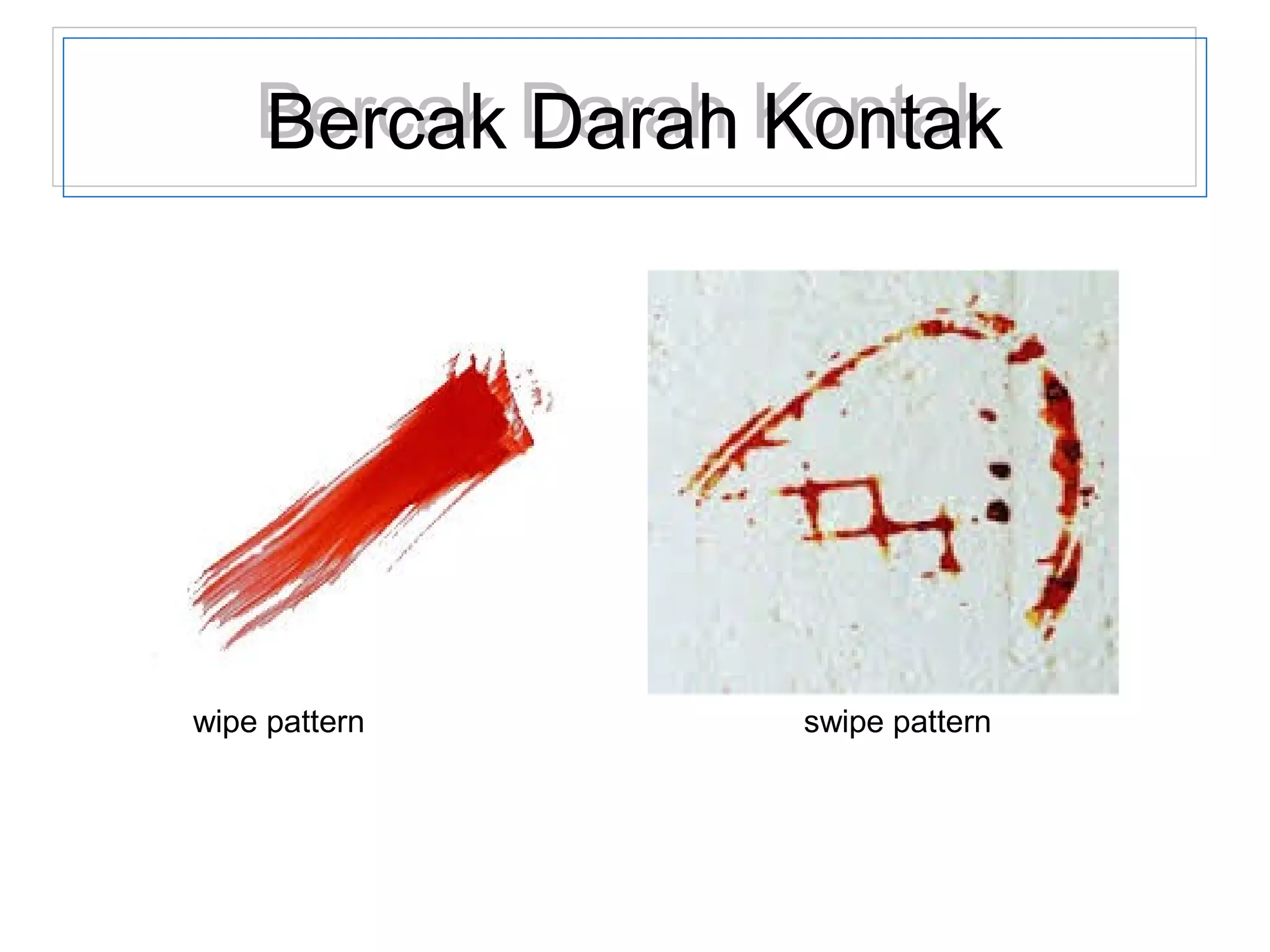 Bloodstain analysis forensik fix | PPT