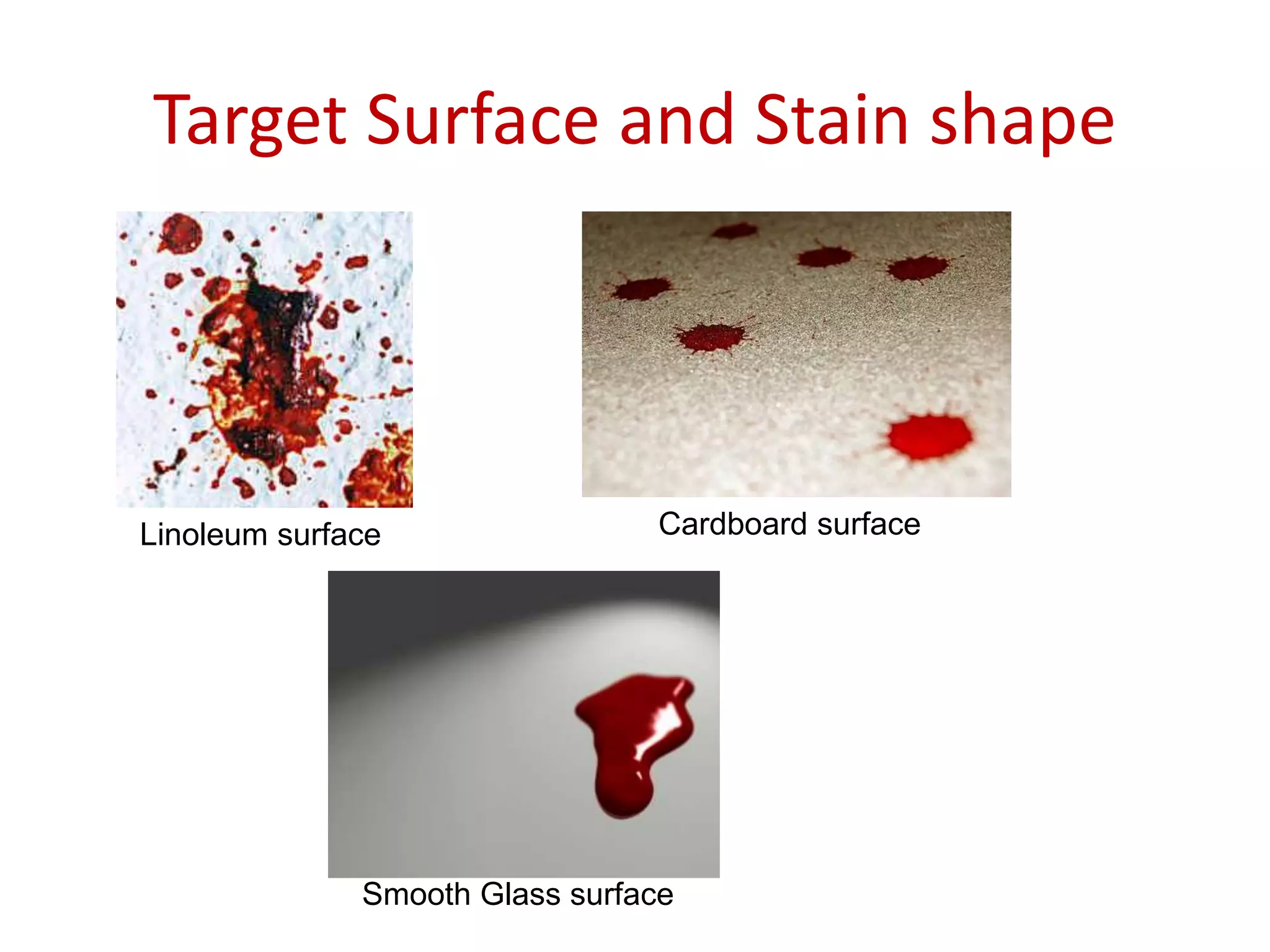 Blood stain pattern analysis | PPT