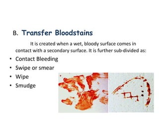 Blood stain pattern analysis | PPT